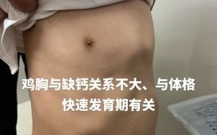 佝偻病鸡胸症状图片_佝偻病鸡胸能治好吗