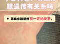荨麻疹是肝癌的前兆吗_荨麻疹和肝癌的关系
