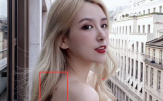 草莓印怎么快速消除_草莓印多久能自然消退