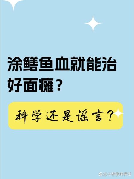 黄鳝血治面瘫真的有用吗_面瘫用黄鳝血怎么用-第2张图片-山城妙识