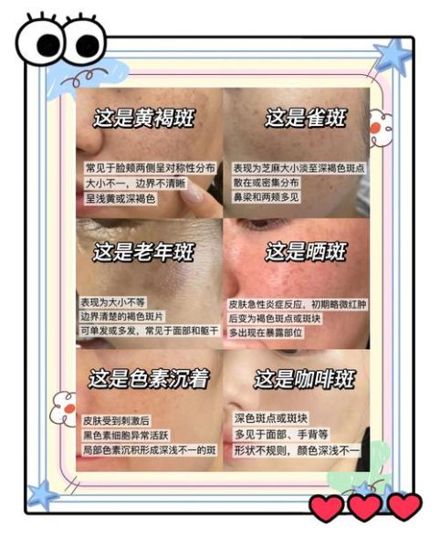 祛斑方法有哪些_祛斑效果最好的方法-第1张图片-山城妙识 祛斑方法有哪些_祛斑效果最好的方法-第1张图片-山城妙识