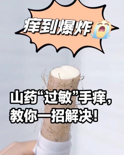 削完山药怎么止痒_山药手痒快速止痒方法-第1张图片-山城妙识