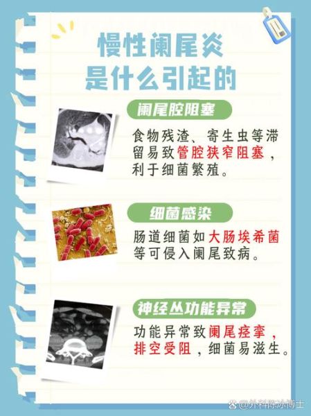 阑尾炎是怎么引起的_阑尾炎发作原因有哪些-第1张图片-山城妙识