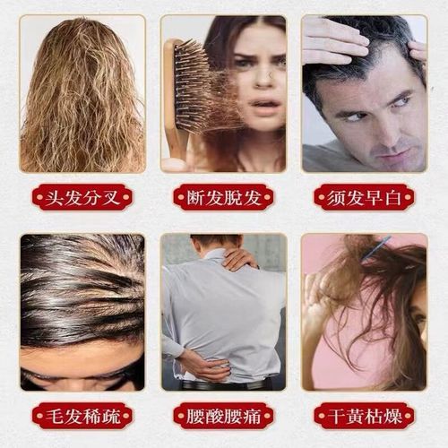 乌发茶能治白发吗_乌发茶效果怎么样-第1张图片-山城妙识 乌发茶能治白发吗_乌发茶效果怎么样-第1张图片-山城妙识