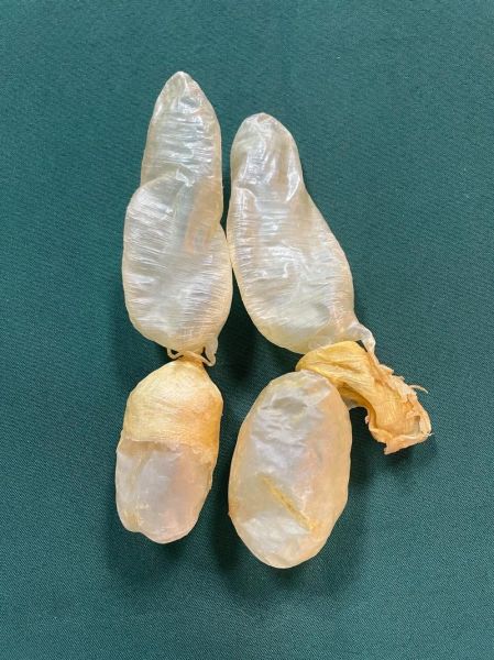 鱼鳔价格多少钱一斤_鱼鳔怎么挑选才划算-第3张图片-山城妙识 鱼鳔价格多少钱一斤_鱼鳔怎么挑选才划算-第3张图片-山城妙识