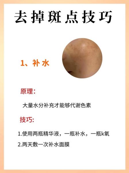 祛斑效果最好的方法是什么_祛斑最有效的办法有哪些-第2张图片-山城妙识 祛斑效果最好的方法是什么_祛斑最有效的办法有哪些-第2张图片-山城妙识