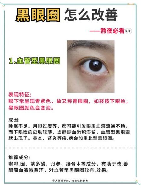 黑眼圈很重怎么消除_黑眼圈怎么快速淡化-第3张图片-山城妙识 黑眼圈很重怎么消除_黑眼圈怎么快速淡化-第3张图片-山城妙识