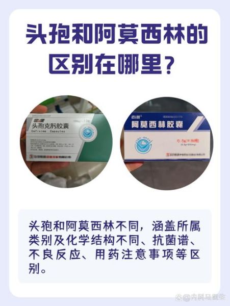 阿莫西林是消炎药吗_阿莫西林和头孢区别-第1张图片-山城妙识