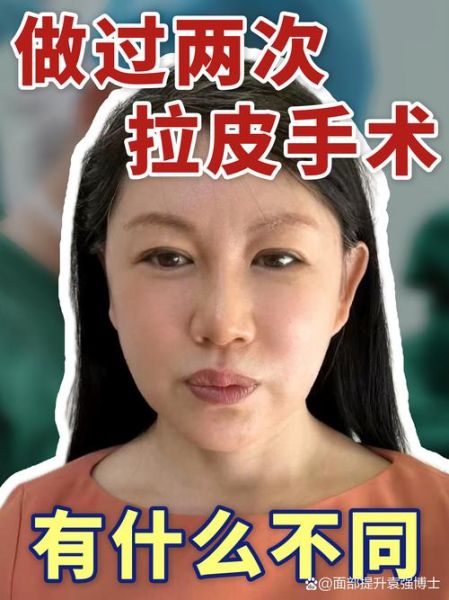 面部拉皮手术怎么做_面部拉皮能维持多久-第1张图片-山城妙识