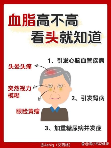 血脂高有什么症状_血脂高身体4个表现-第2张图片-山城妙识 血脂高有什么症状_血脂高身体4个表现-第2张图片-山城妙识