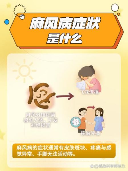 麻风病会传染吗_麻风病早期症状有哪些-第3张图片-山城妙识