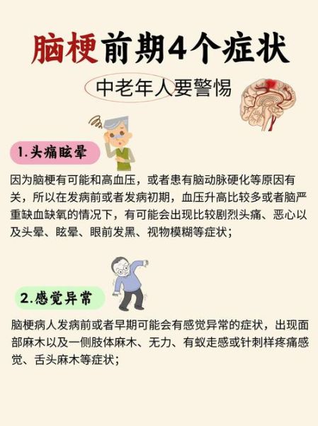 脑梗塞早期6大症状有哪些_如何快速识别-第1张图片-山城妙识 脑梗塞早期6大症状有哪些_如何快速识别-第1张图片-山城妙识