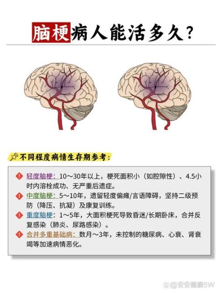 脑梗塞早期6大症状有哪些_如何快速识别-第2张图片-山城妙识 脑梗塞早期6大症状有哪些_如何快速识别-第2张图片-山城妙识