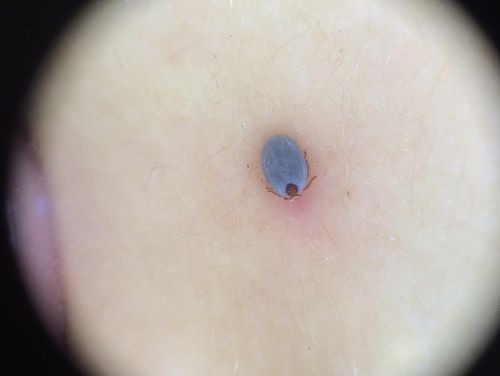 莲蓬乳是什么图片_莲蓬乳图片真的吓人吗-第2张图片-山城妙识