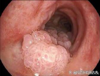 菜花病症状图片大全_菜花病初期长什么样-第1张图片-山城妙识