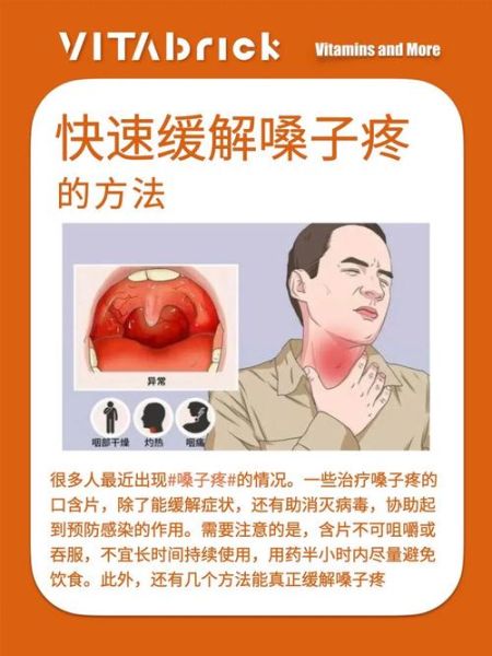 喉咙痛怎么办_快速缓解小妙招-第1张图片-山城妙识