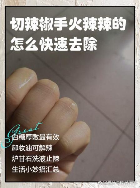 辣椒辣手怎么办_最有效的止痛方法-第1张图片-山城妙识