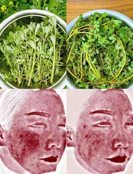 马齿苋敷脸过敏怎么办_马齿苋敷脸越敷越厉害原因-第2张图片-山城妙识