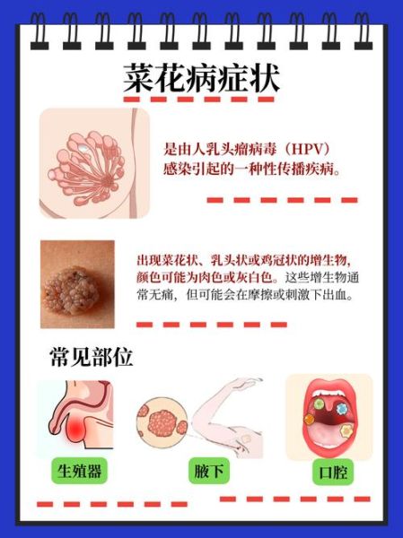 菜花病早期症状图片_怎么辨别真假-第1张图片-山城妙识