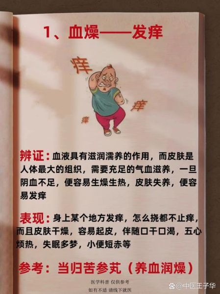 血热症状有哪些_血热怎么调理-第2张图片-山城妙识
