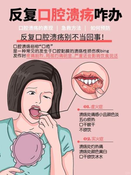 口腔溃疡怎么快速止痛_口腔溃疡立刻止疼的方法-第1张图片-山城妙识