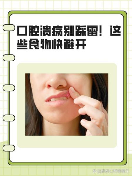 口腔溃疡怎么快速止痛_口腔溃疡立刻止疼的方法-第3张图片-山城妙识