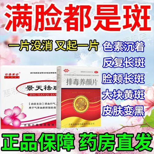 黄褐斑内调吃什么药_黄褐斑内调中药有哪些-第1张图片-山城妙识