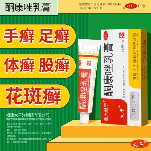 鹅掌风怎么治疗_鹅掌风用什么药膏好-第2张图片-山城妙识