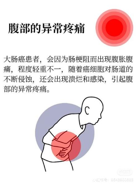 直肠癌的早期症状有哪些_直肠癌早期会疼吗-第1张图片-山城妙识