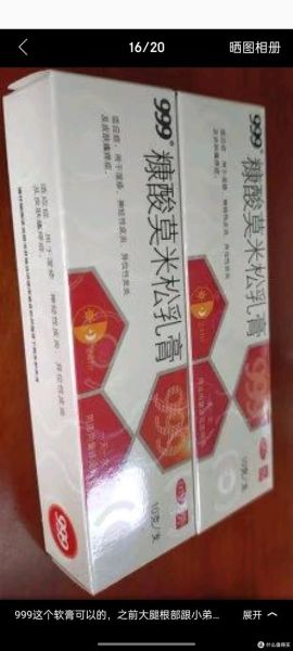 皮肤过敏用什么药膏_过敏性皮炎擦什么药好-第1张图片-山城妙识