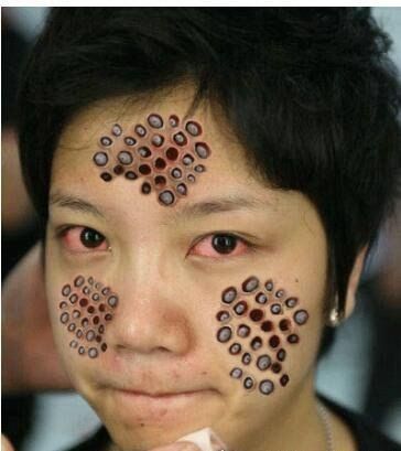 莲蓬手指恶心图是什么_为什么让人不适-第1张图片-山城妙识