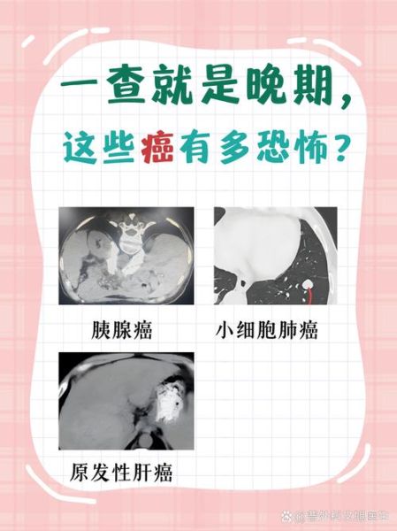 癌症是骗局吗_癌症治疗真相-第2张图片-山城妙识 癌症是骗局吗_癌症治疗真相-第2张图片-山城妙识
