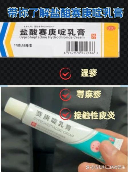 湿疹吃什么药效果最好_湿疹止痒药有哪些-第1张图片-山城妙识