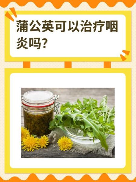 蒲公英治咽炎真的有用吗_慢性咽炎喝多久见效-第2张图片-山城妙识 蒲公英治咽炎真的有用吗_慢性咽炎喝多久见效-第2张图片-山城妙识