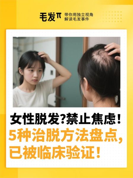 文慧洗头后掉发怎么办_文慧洗头后头皮痒怎么缓解-第1张图片-山城妙识 文慧洗头后掉发怎么办_文慧洗头后头皮痒怎么缓解-第1张图片-山城妙识