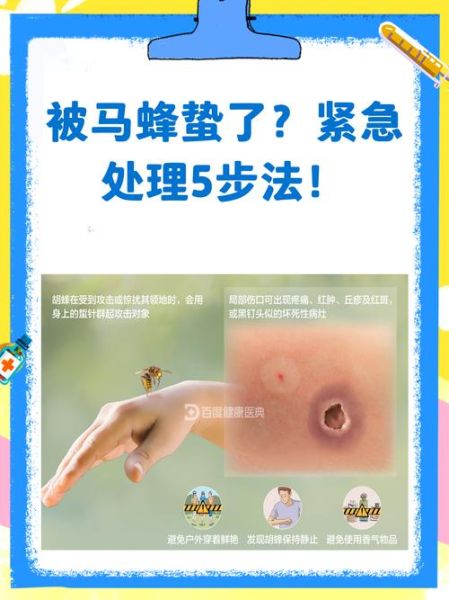 马蜂图片怎么区分种类_被马蜂蛰了怎么办-第1张图片-山城妙识 马蜂图片怎么区分种类_被马蜂蛰了怎么办-第1张图片-山城妙识