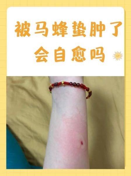 马蜂图片怎么区分种类_被马蜂蛰了怎么办-第3张图片-山城妙识 马蜂图片怎么区分种类_被马蜂蛰了怎么办-第3张图片-山城妙识