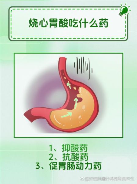胃酸过多吃什么食物缓解_胃酸烧心怎么办-第1张图片-山城妙识 胃酸过多吃什么食物缓解_胃酸烧心怎么办-第1张图片-山城妙识