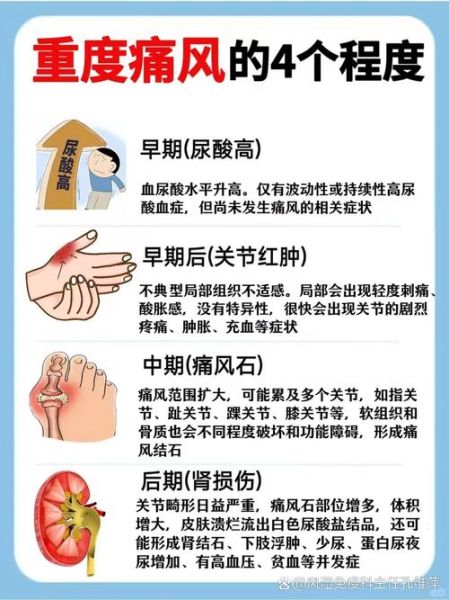 男性尿酸高的早期症状_如何判断-第1张图片-山城妙识 男性尿酸高的早期症状_如何判断-第1张图片-山城妙识