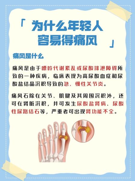男性尿酸高的早期症状_如何判断-第3张图片-山城妙识 男性尿酸高的早期症状_如何判断-第3张图片-山城妙识