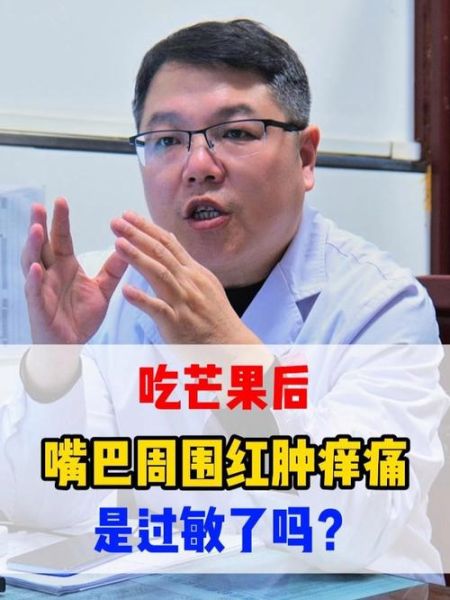 芒果过敏嘴唇长小颗粒怎么办_多久能好-第2张图片-山城妙识 芒果过敏嘴唇长小颗粒怎么办_多久能好-第2张图片-山城妙识