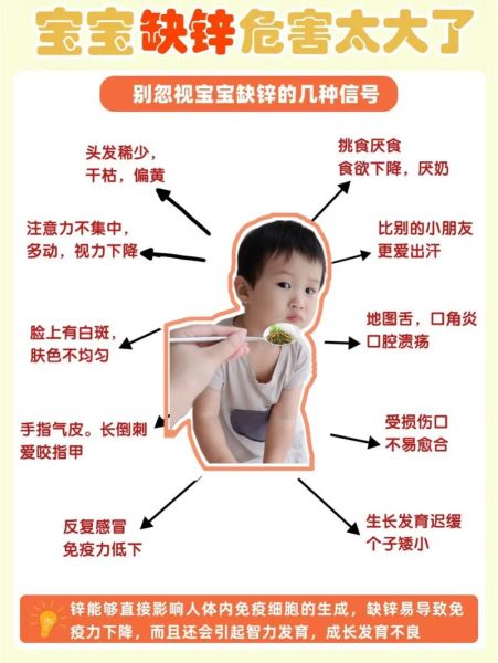儿童缺锌的症状有哪些_如何判断孩子是否缺锌-第1张图片-山城妙识 儿童缺锌的症状有哪些_如何判断孩子是否缺锌-第1张图片-山城妙识