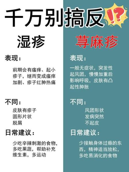 过敏和湿疹的区别_如何判断是过敏还是湿疹-第1张图片-山城妙识 过敏和湿疹的区别_如何判断是过敏还是湿疹-第1张图片-山城妙识