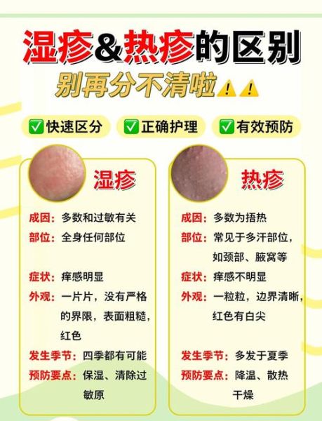 过敏和湿疹的区别_如何判断是过敏还是湿疹-第2张图片-山城妙识 过敏和湿疹的区别_如何判断是过敏还是湿疹-第2张图片-山城妙识