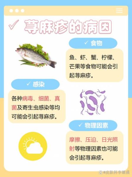 荨麻疹是肝癌的前兆吗_荨麻疹和肝癌的关系-第2张图片-山城妙识 荨麻疹是肝癌的前兆吗_荨麻疹和肝癌的关系-第2张图片-山城妙识