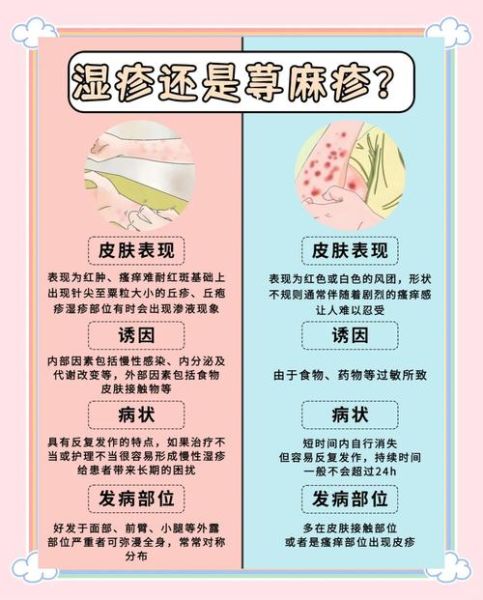 过敏性荨麻疹图片_如何辨别风团与湿疹-第3张图片-山城妙识 过敏性荨麻疹图片_如何辨别风团与湿疹-第3张图片-山城妙识