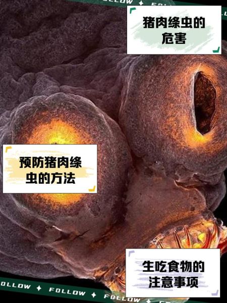 猪肉绦虫是什么动物_猪肉绦虫对人体有哪些危害-第1张图片-山城妙识 猪肉绦虫是什么动物_猪肉绦虫对人体有哪些危害-第1张图片-山城妙识