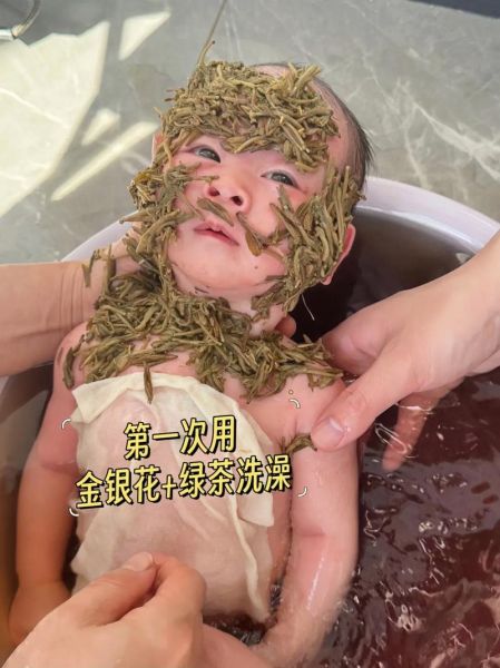 蚕豆病可以吃金银花吗_蚕豆病金银花禁忌-第1张图片-山城妙识 蚕豆病可以吃金银花吗_蚕豆病金银花禁忌-第1张图片-山城妙识