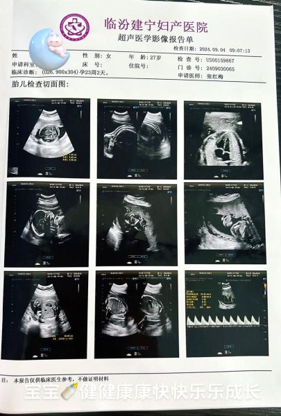 大排畸是四维彩超吗_两者区别在哪-第2张图片-山城妙识 大排畸是四维彩超吗_两者区别在哪-第2张图片-山城妙识