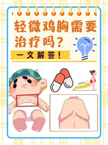 儿童鸡胸的症状有哪些_鸡胸图片怎么看-第2张图片-山城妙识 儿童鸡胸的症状有哪些_鸡胸图片怎么看-第2张图片-山城妙识